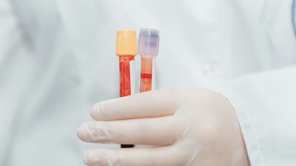 Biopsja tarczycy - na czym polega i kiedy jest potrzebna?
